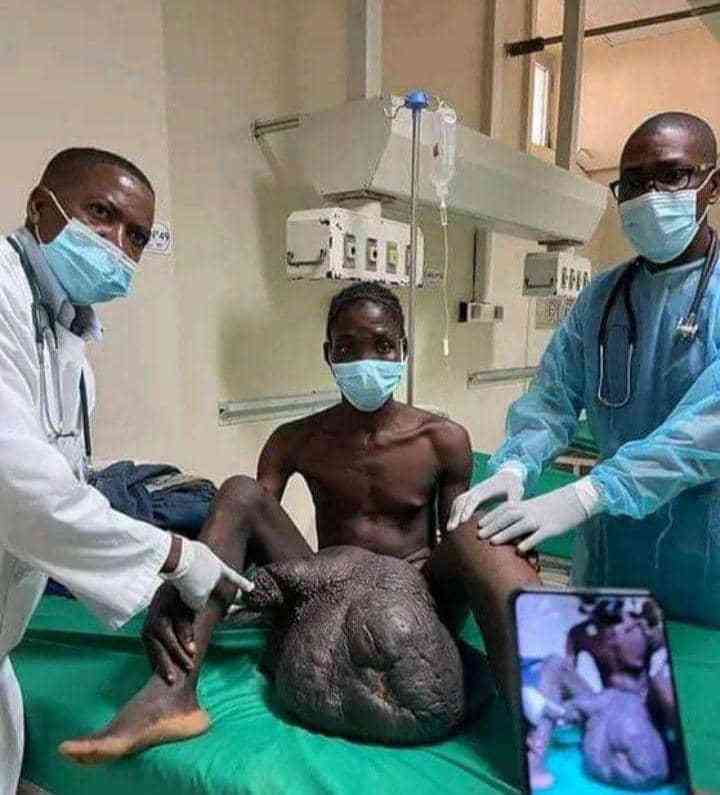 Penis enlargement - MirrorLog.com